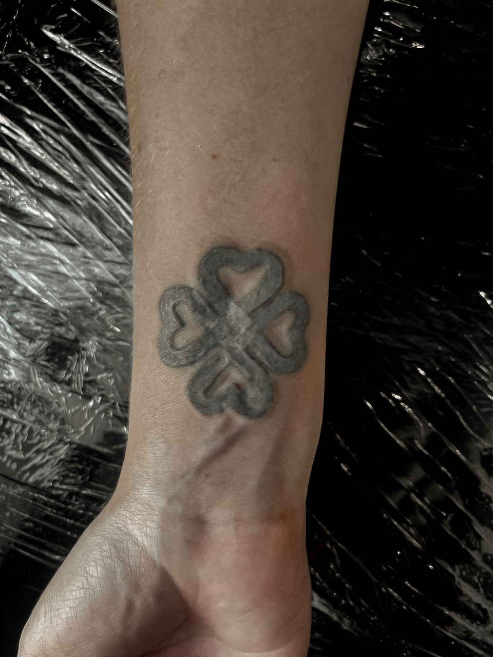 Laser removal master Egor Privalov - VeAn Tattoo